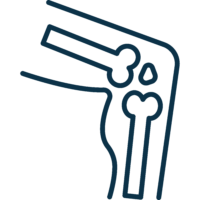 Becker Overview : Becker Muscular Dystrophy